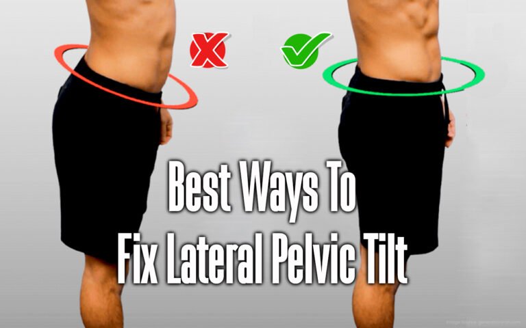 Best Ways To Fix Lateral Pelvic Tilt - Your Body Posture